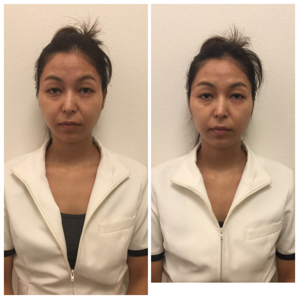 小顔研修は楽しい！！ | miisha | 文京区、茗荷谷の エステ&まつげまゆげケアサロン